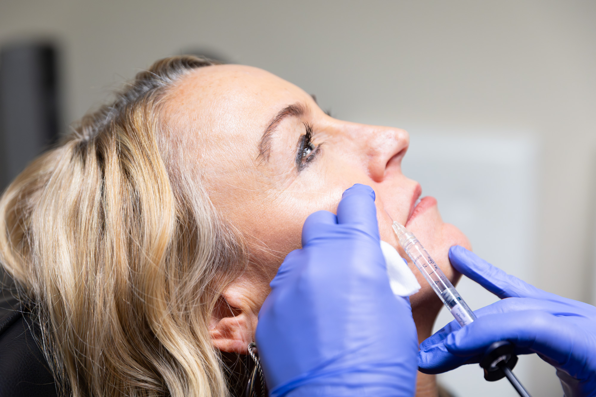 The Truth About Dermal Filler in St. Petersburg | Success by Design